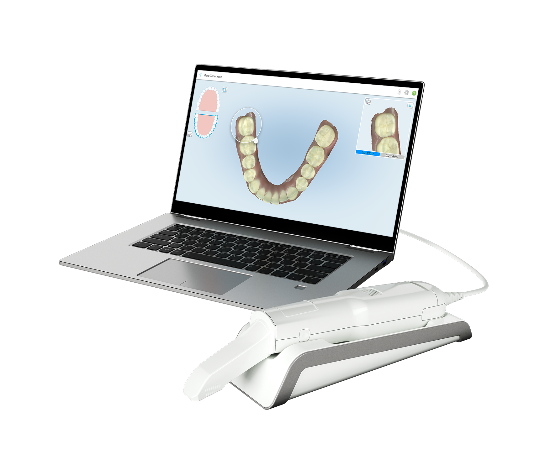 iTero Element Flex - Scanner intraorale odontoiatra